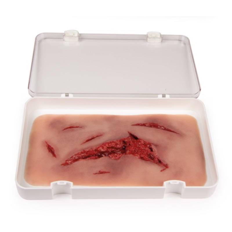 Erler Zimmer Wound Moulage Large Lacerations | Health and Care